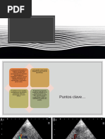 Escala ASPECTS | PDF