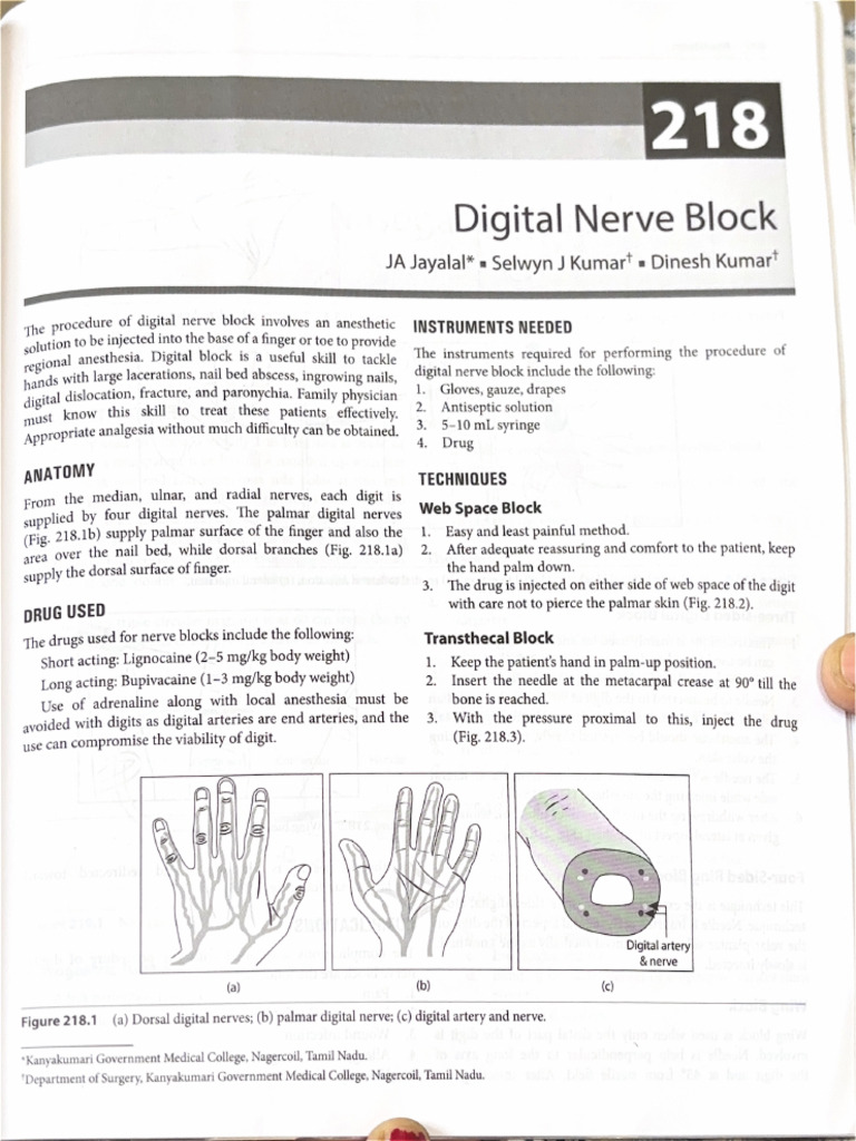 Digital Nerve Block | PDF