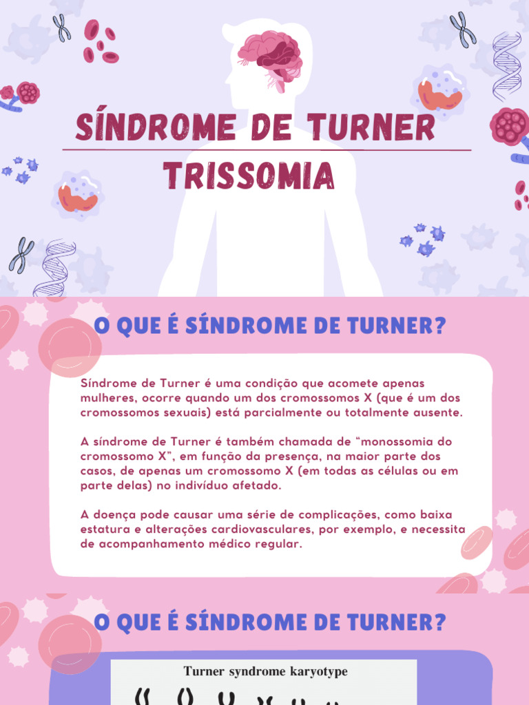 Síndrome de Turner Trissomia - 20250527 - 202429 - 0000 | PDF ...