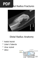 Frykman Classification of Distal Radius Fractures | PDF