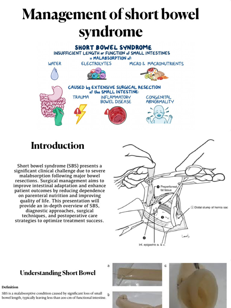 Short Bowel Syndrome Management Guide | PDF | Surgery | Medical Specialties