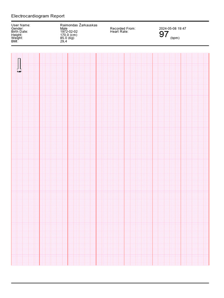 ECG Report | PDF