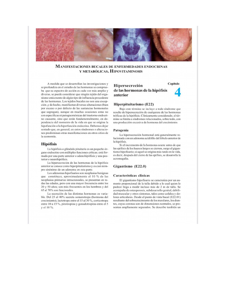 Capítulo 4 para Imprimir 2 | PDF