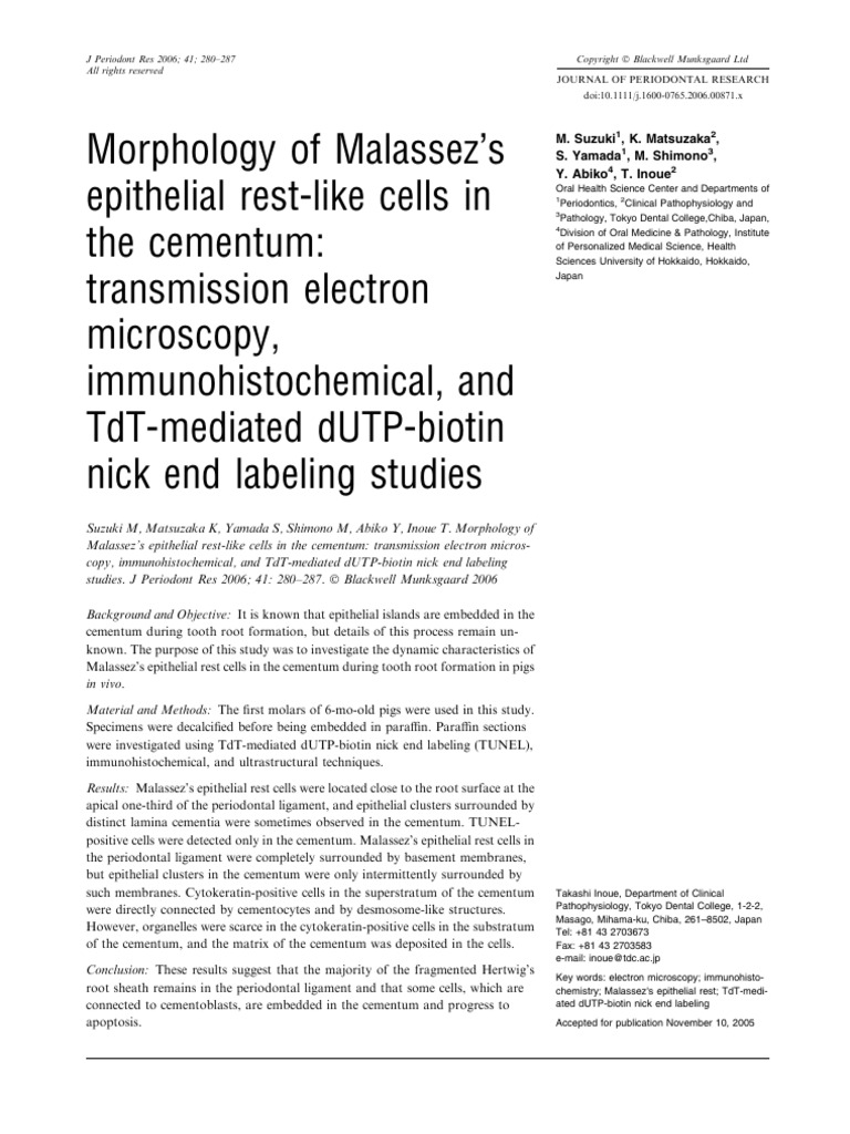 J of Periodontal Research - 2006 - Suzuki - Morphology of Malassez S Epithelial Rest Like Cells ...