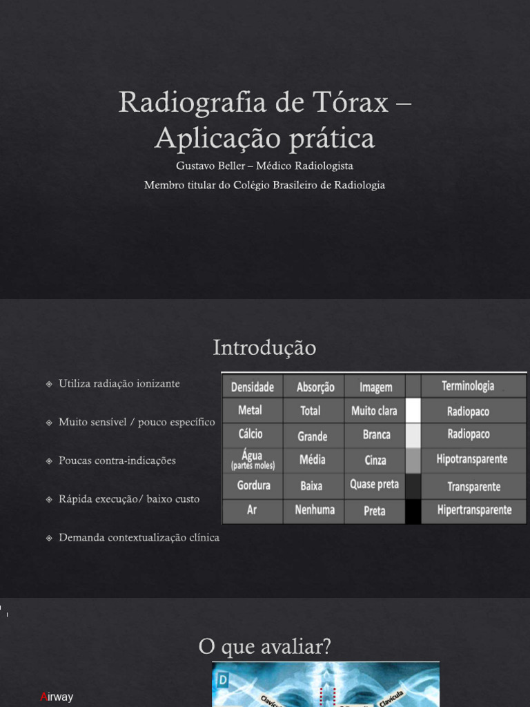3-Radiografia de TÃ Rax.2 | PDF