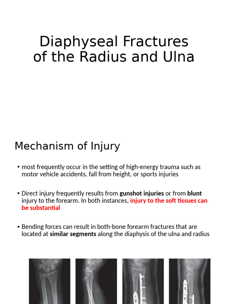 Forearm FX Adult-1 | PDF