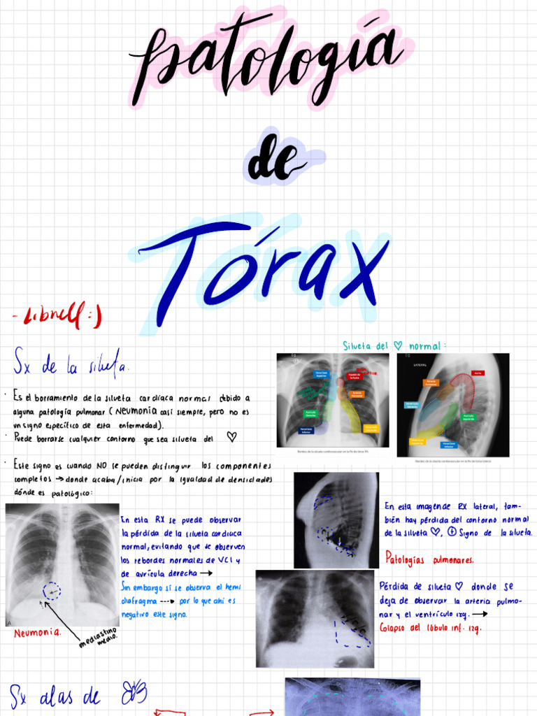 Patología de Tórax Con Imágenes | PDF | Tórax | Tórax (anatomía humana)