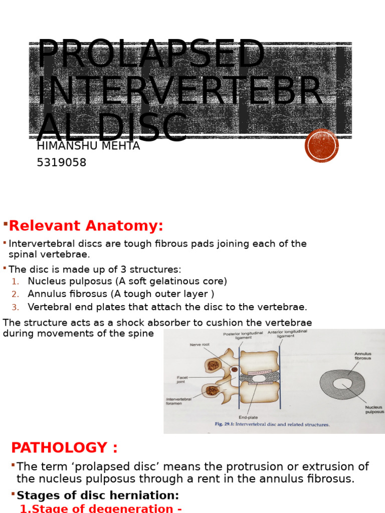 Prolapsed Intervertebral Disc 1 | PDF | Vertebral Column | Human Anatomy