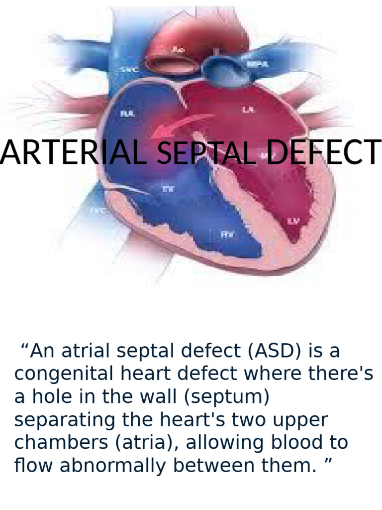 Arterial Septal Defect | PDF