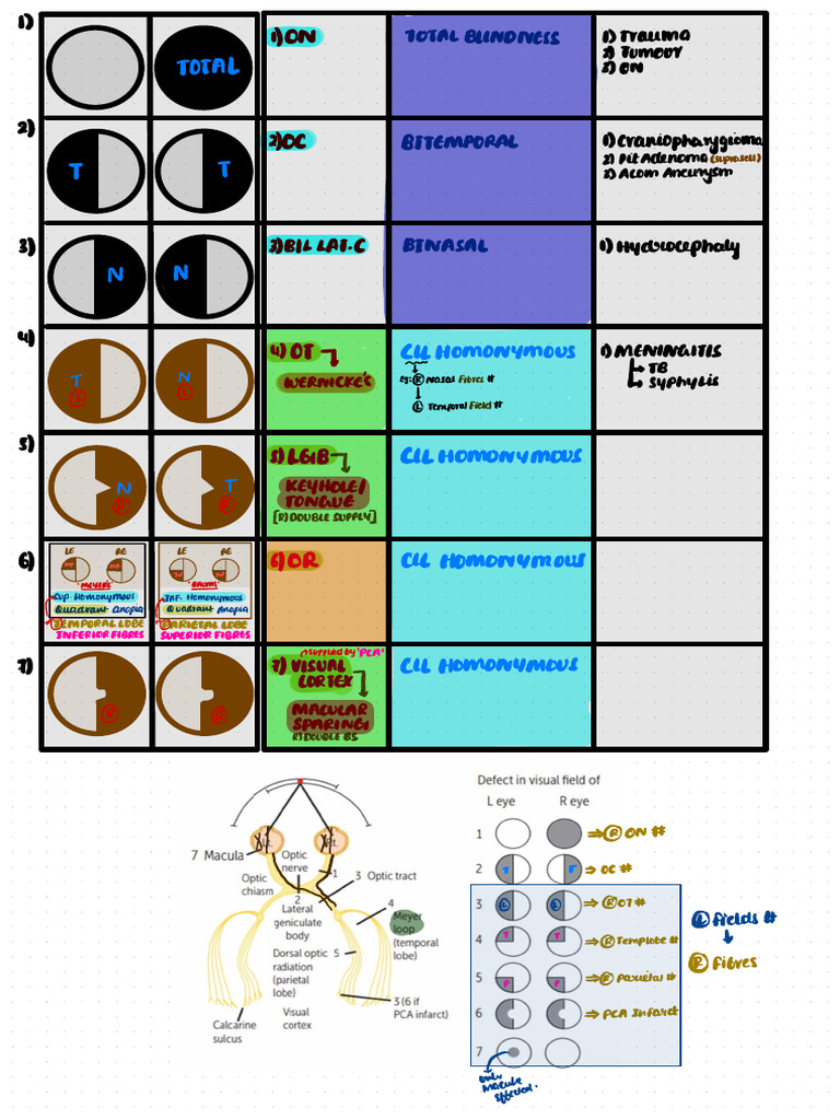 5.visual Pathway Defect | PDF | Cerebrum | Nervous System
