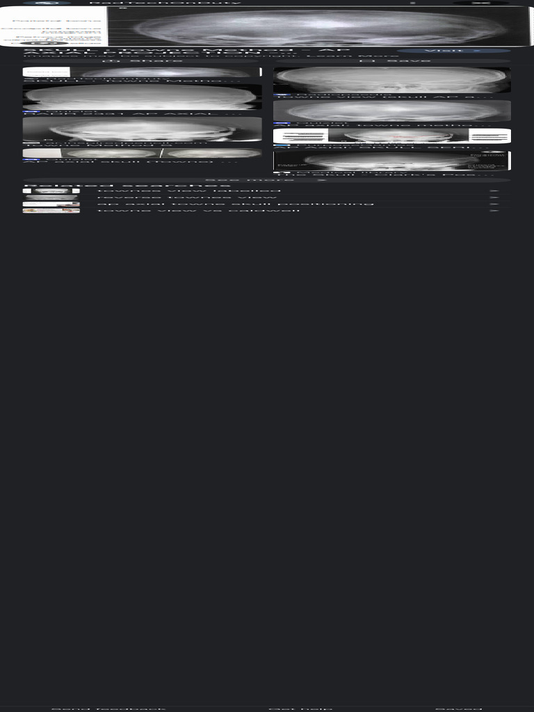 AP Townes Skull Positioning Upright Position - Google Search | PDF