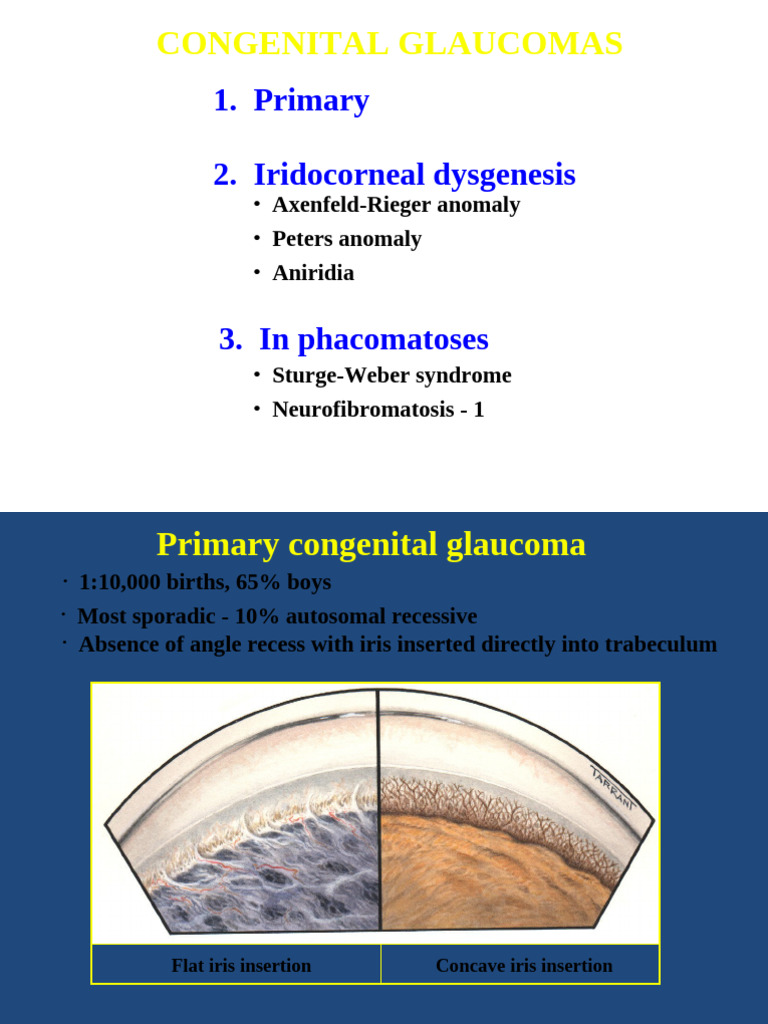 31congenital Glaucomas | PDF | Glaucoma | Human Diseases And Disorders