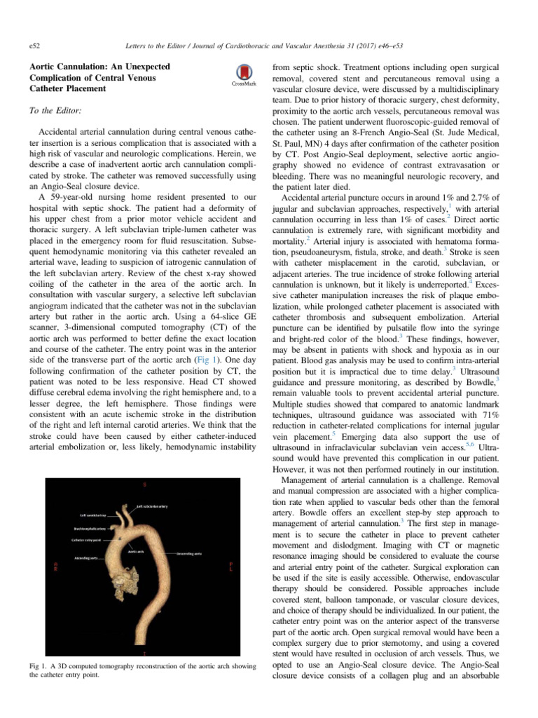 Strong Aortic Cannulation An Unexpected Complica | PDF | Catheter ...