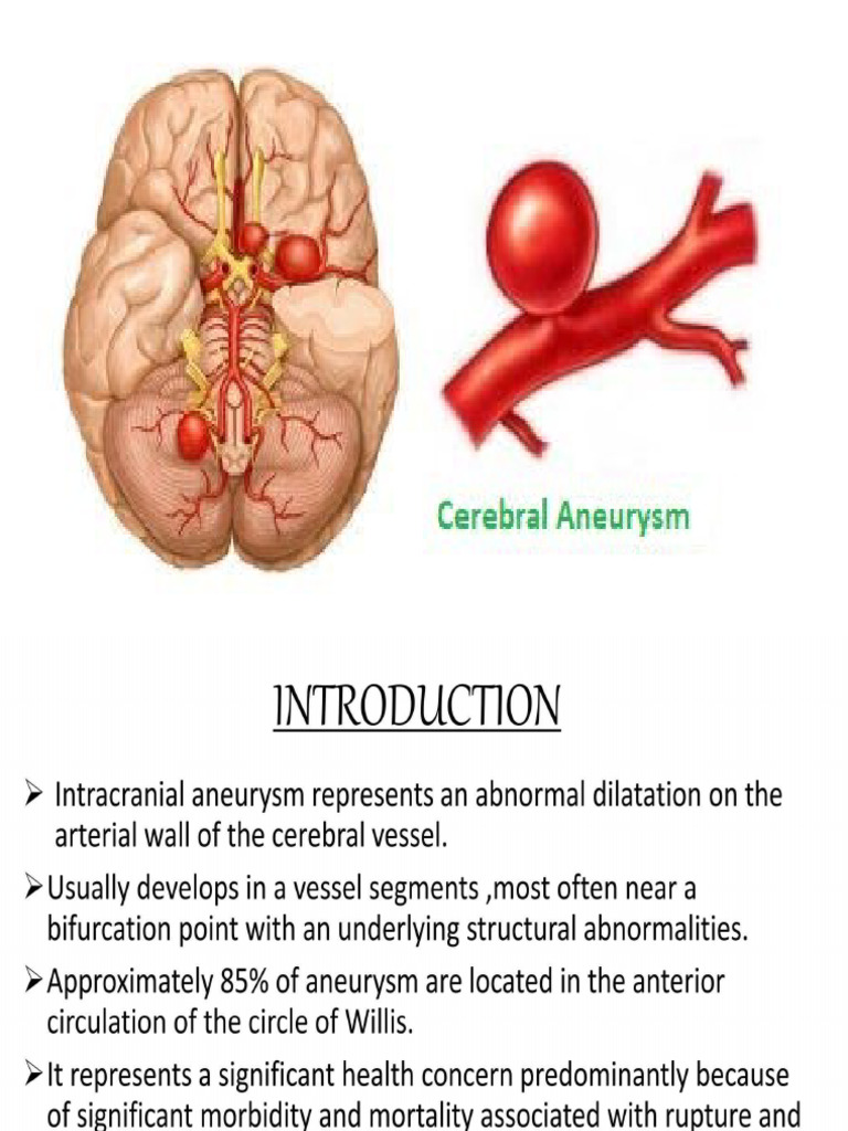 Cerebral Aneurysm | PDF