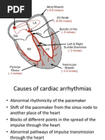 Ventricular Tachycardia - Monomorphic VT - LITFL | PDF ...