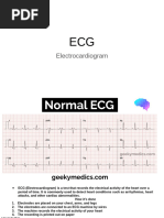 ECG Interpretation Cheat Sheet | PDF | Electrocardiography | Artificial ...