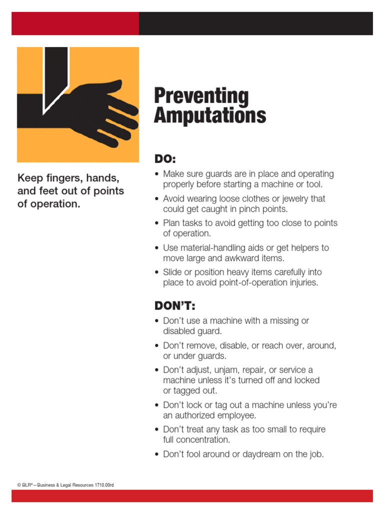 Amputation Prevention Safety Guidelines | PDF