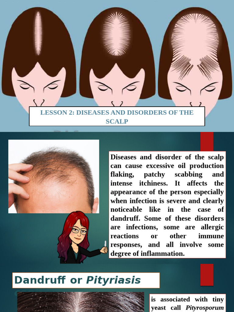 Lesson-2-4th-Grading-Period Technology Livelihood Education | PDF | Hair Loss