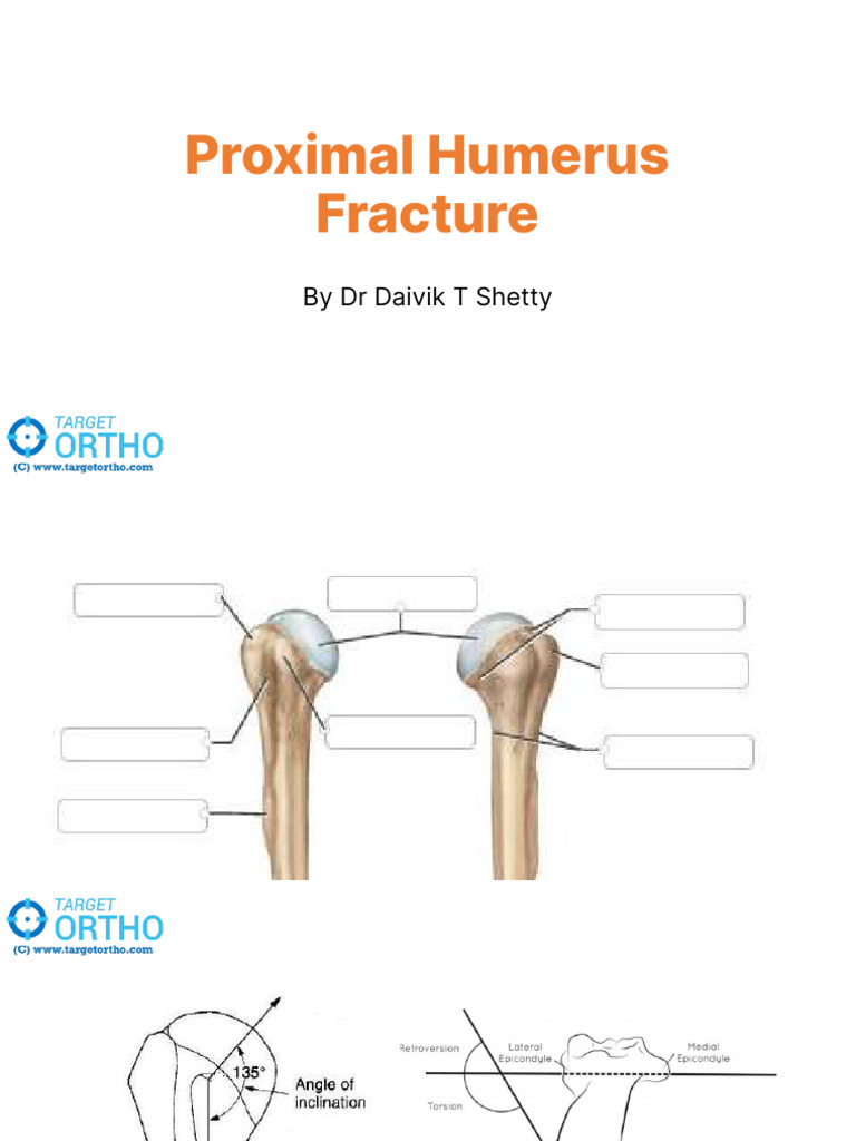 Fracture of Proximal Humerus DrDaivikpdf Lyst1726399966194 | PDF ...