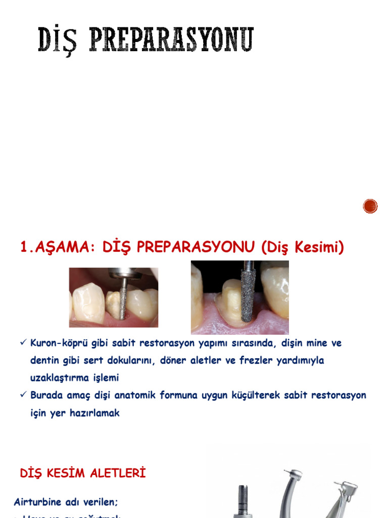 3- Diş Kesim Prensipleri_241010_111301-1 | PDF