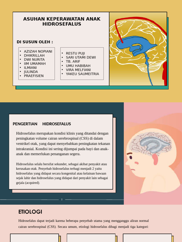 2025 Kel 2 Kep Anak Hidrosefalus | PDF