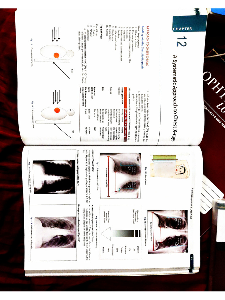 Chest Xrays 12 | PDF