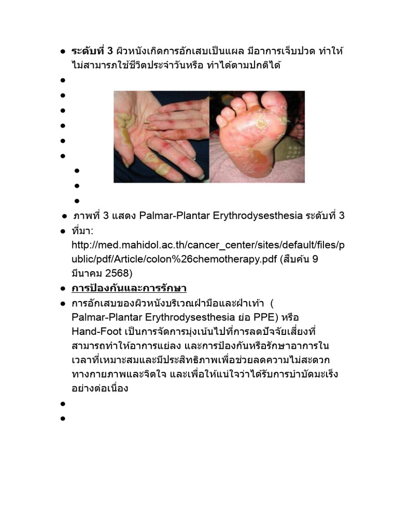 3 Palmar-Plantar Erythrodysesthesia 3 : Ublic/pdf/article/colon ...