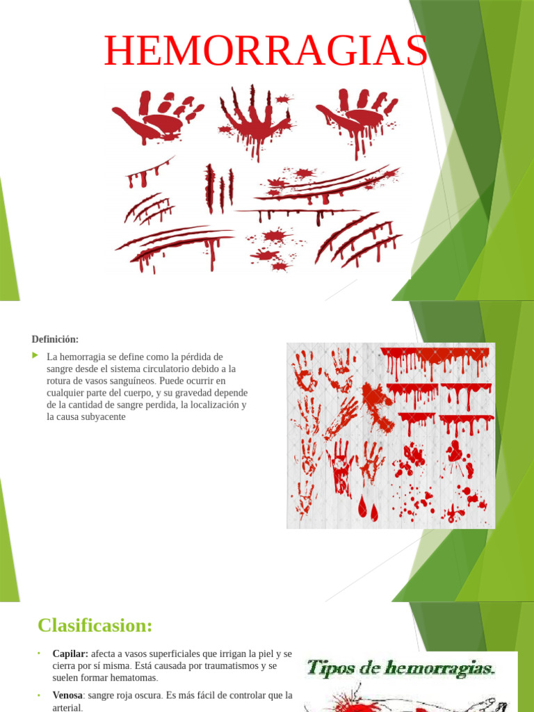 Hemorragias. Rudy | PDF | Herida | Sangrado