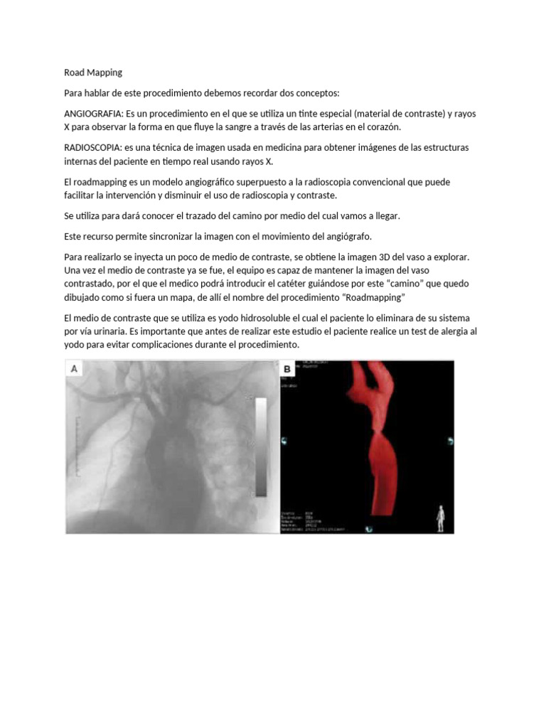 Roadmapping en Angiografía y Radioscopia | PDF
