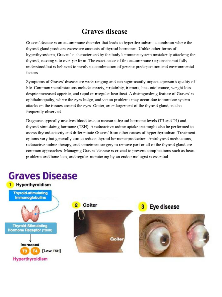 Understanding Graves' Disease Symptoms | PDF