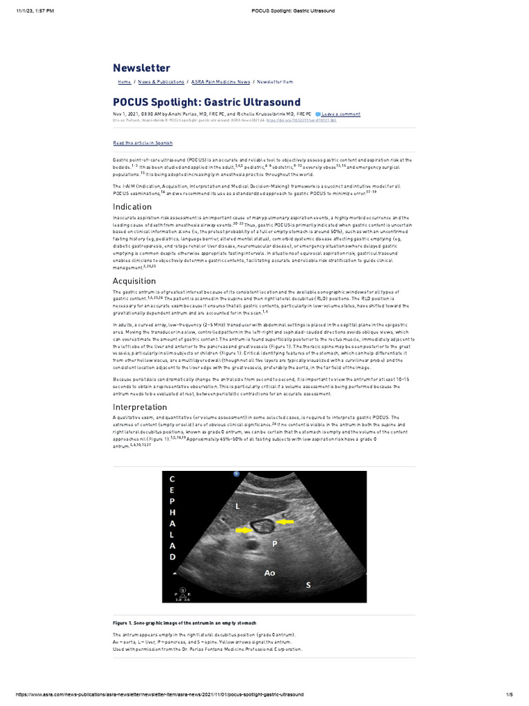 POCUS Spotlight - Gastric Ultrasound | PDF | Anesthesia | Surgery