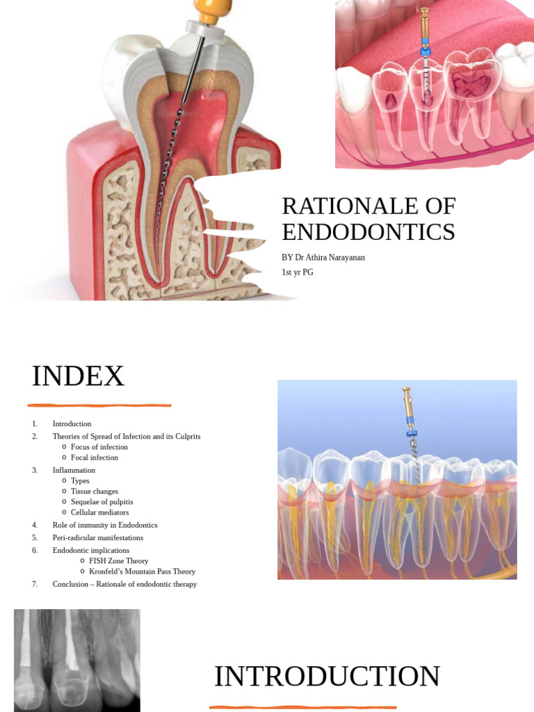 Rationale of Endodontic Treatment | PDF | Immune System | Inflammation