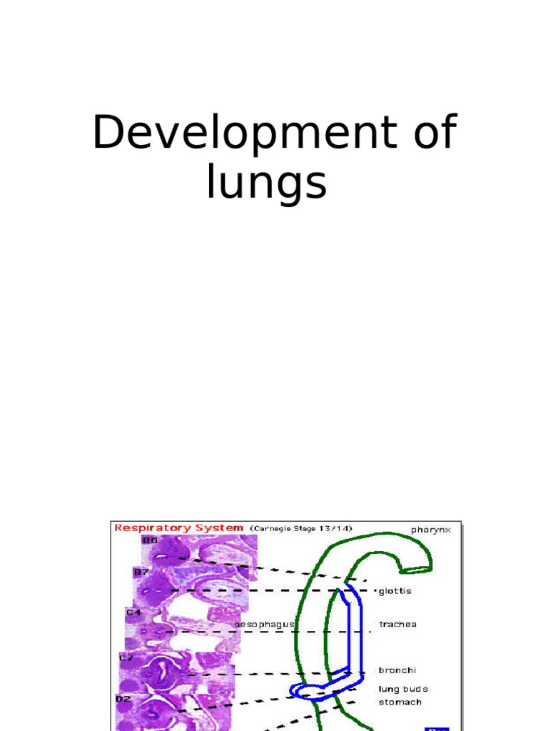 Development of Lung - 11136 - Pediatrics-T - 21-01-2021 | PDF | Lung ...