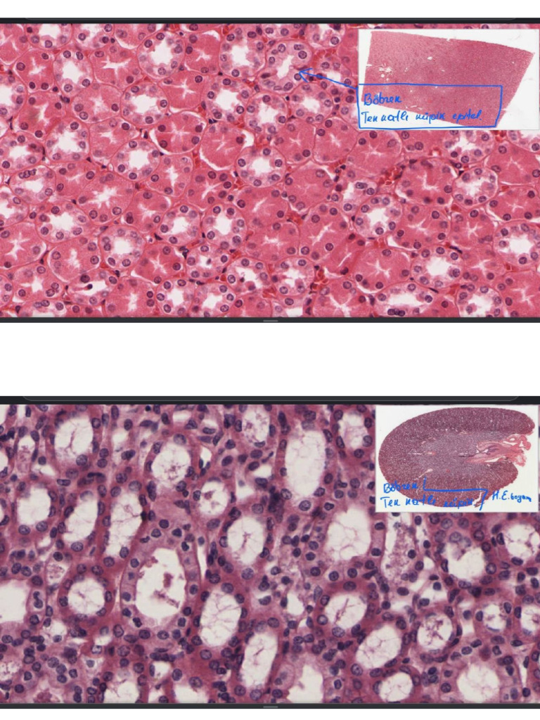 Histo Lab Görüntüleri (Sınav) - 240521 - 080541 - 240521 - 081056 | PDF