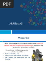 Trigeminismo Ventricular: Definición y Tratamiento | PDF