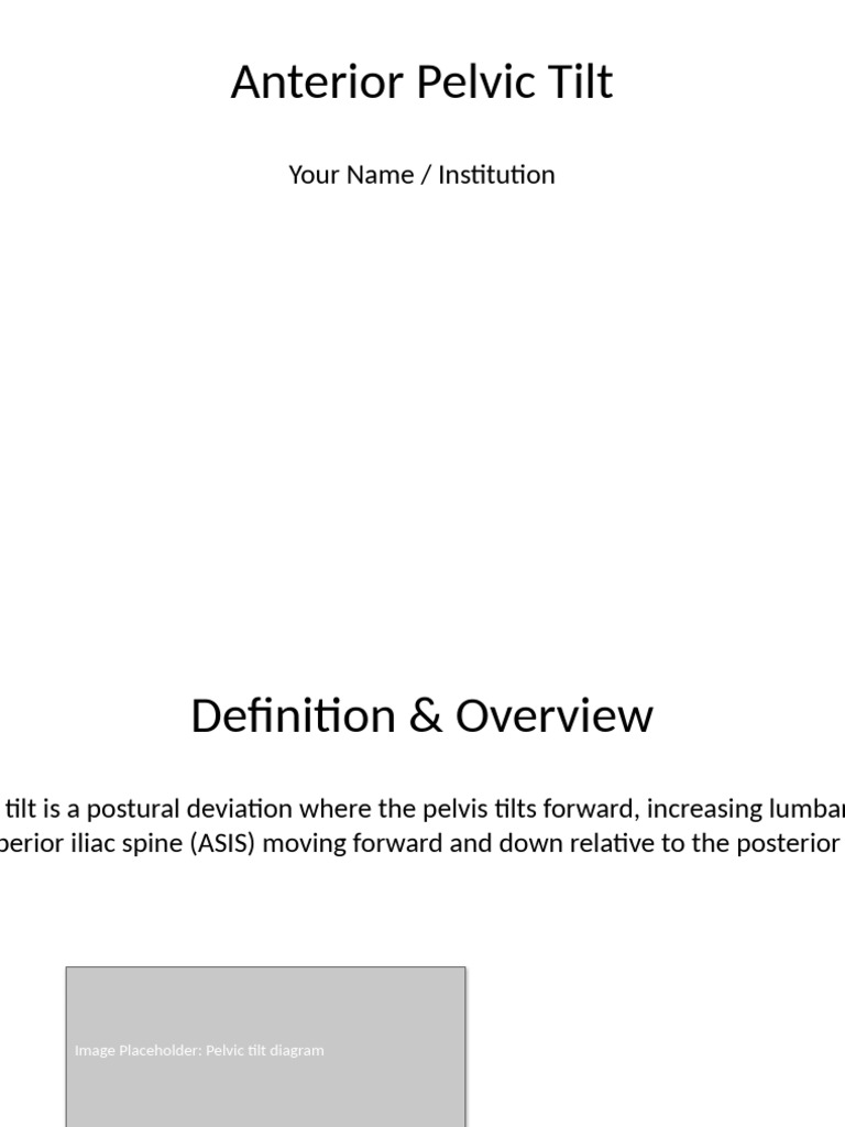 Understanding Anterior Pelvic Tilt | PDF