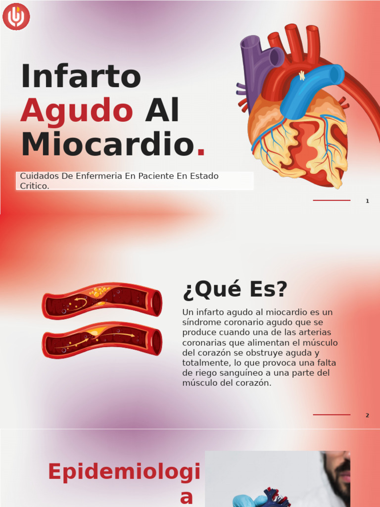 Infarto Al Miocardio: Agudo | PDF | Infarto de miocardio | Fisiología