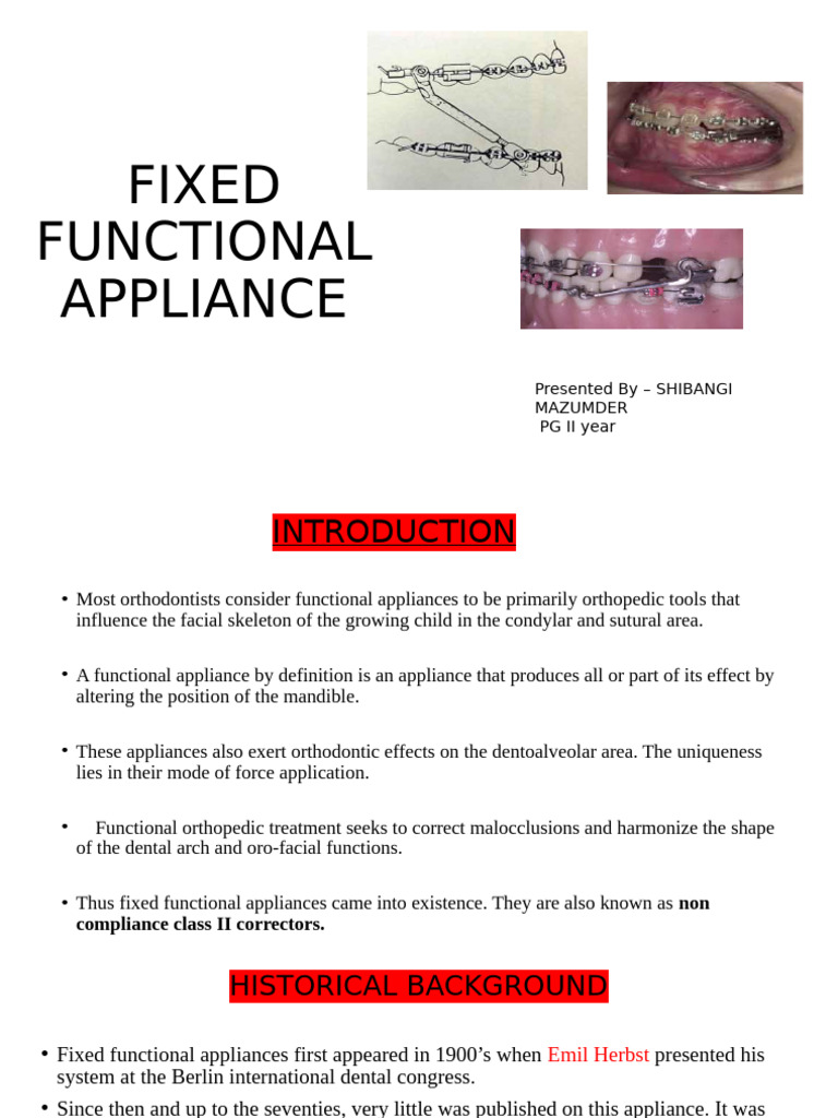 Fixed functional appliance | PDF | Orthodontics | Dental Anatomy