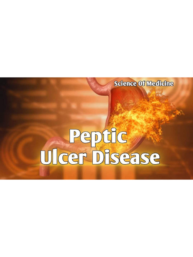 Peptic Ulcer | PDF