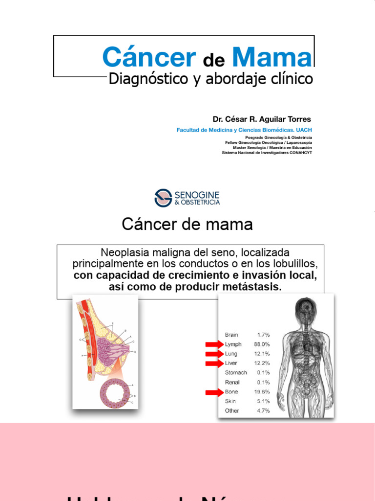 Diagnóstico y Tratamiento Cáncer de Mama | PDF | Cáncer de mama | Biopsia