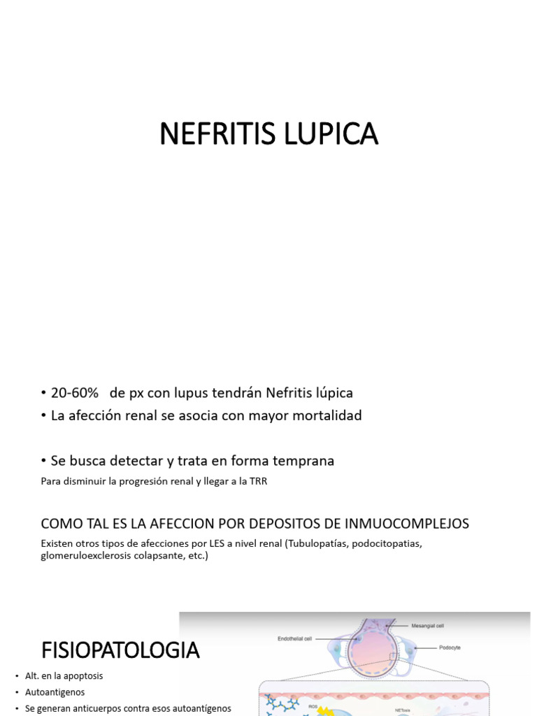 Nefritis Lupica | PDF