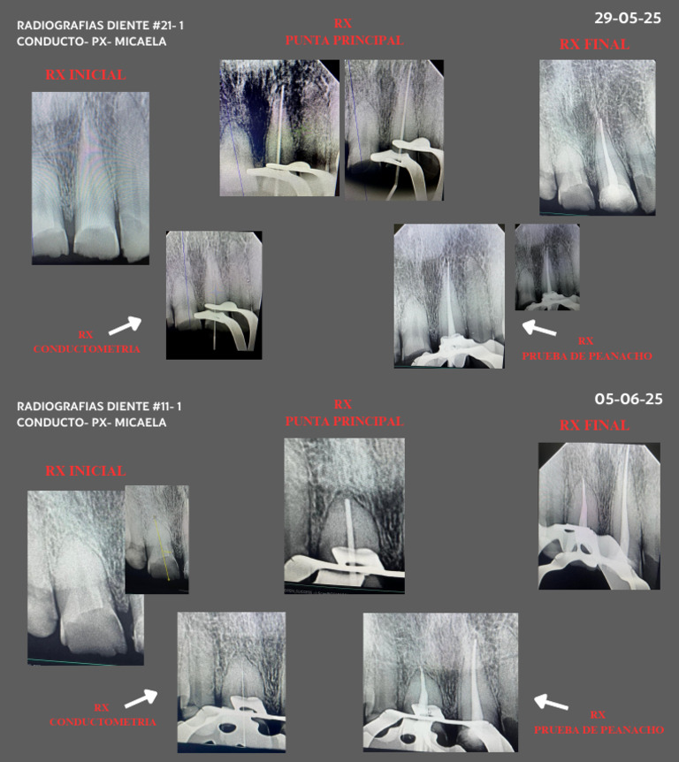 Radiografías y Conductometría Dental | PDF