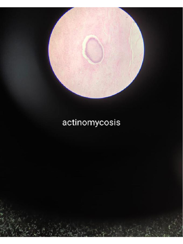 OP Slides and Specimens | PDF
