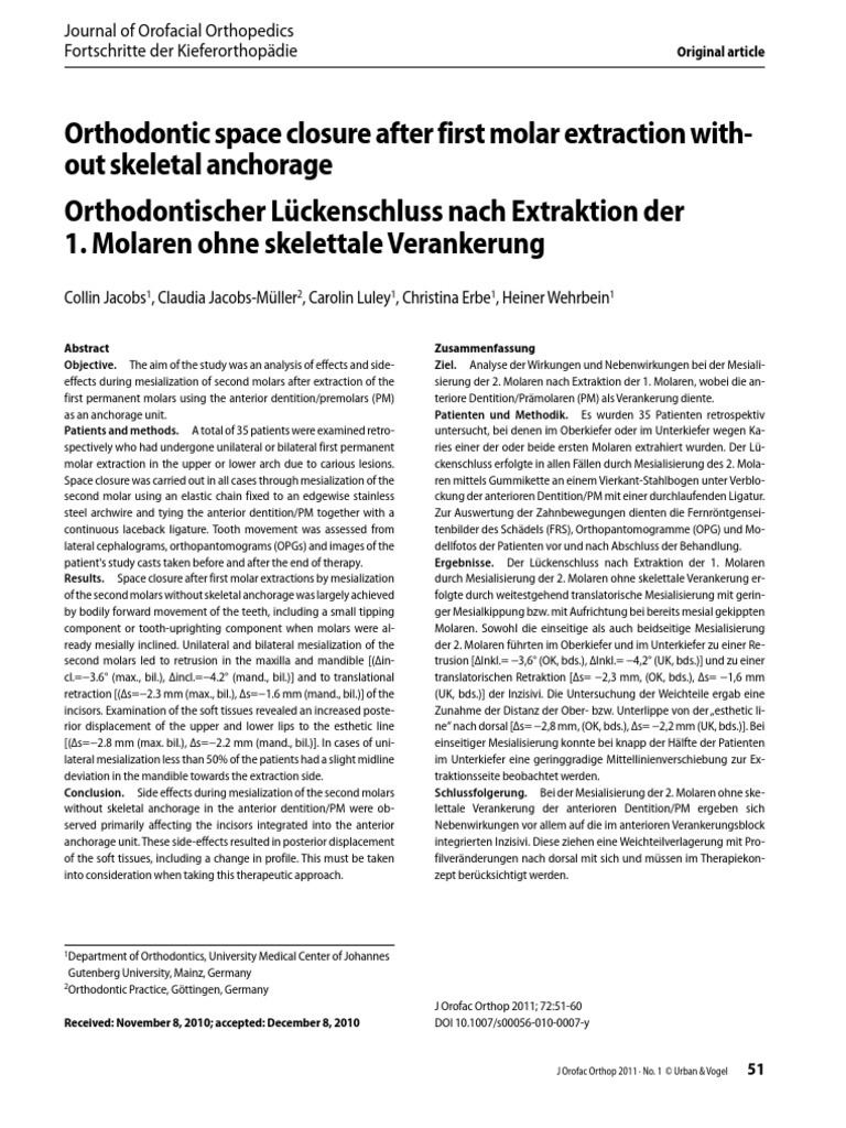 Orthodontic Space Closure After First Molar Extraction Without Skeletal ...