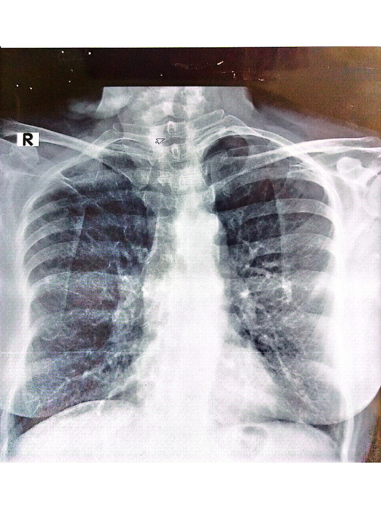 Chest | PDF