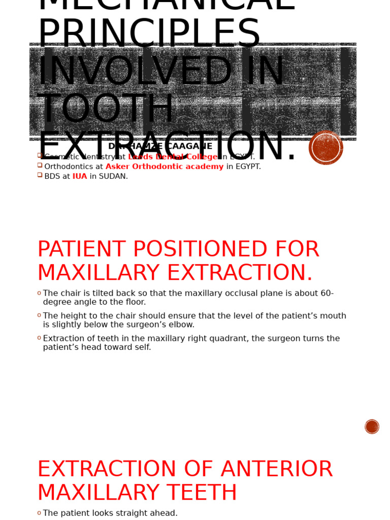 Mechanical Principles in Tooth Extraction | PDF | Dentistry | Orthodontics