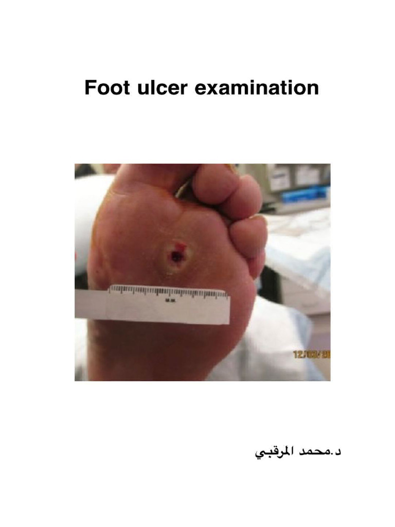 4 Foot Ulcer Examination د محمد مازن | PDF