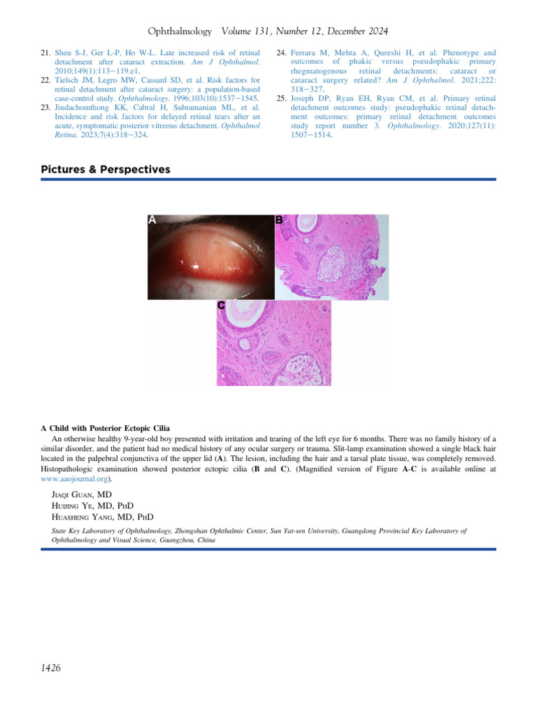 A Child With Posterior Ectopic Cilia - 2023 - Ophtha | PDF