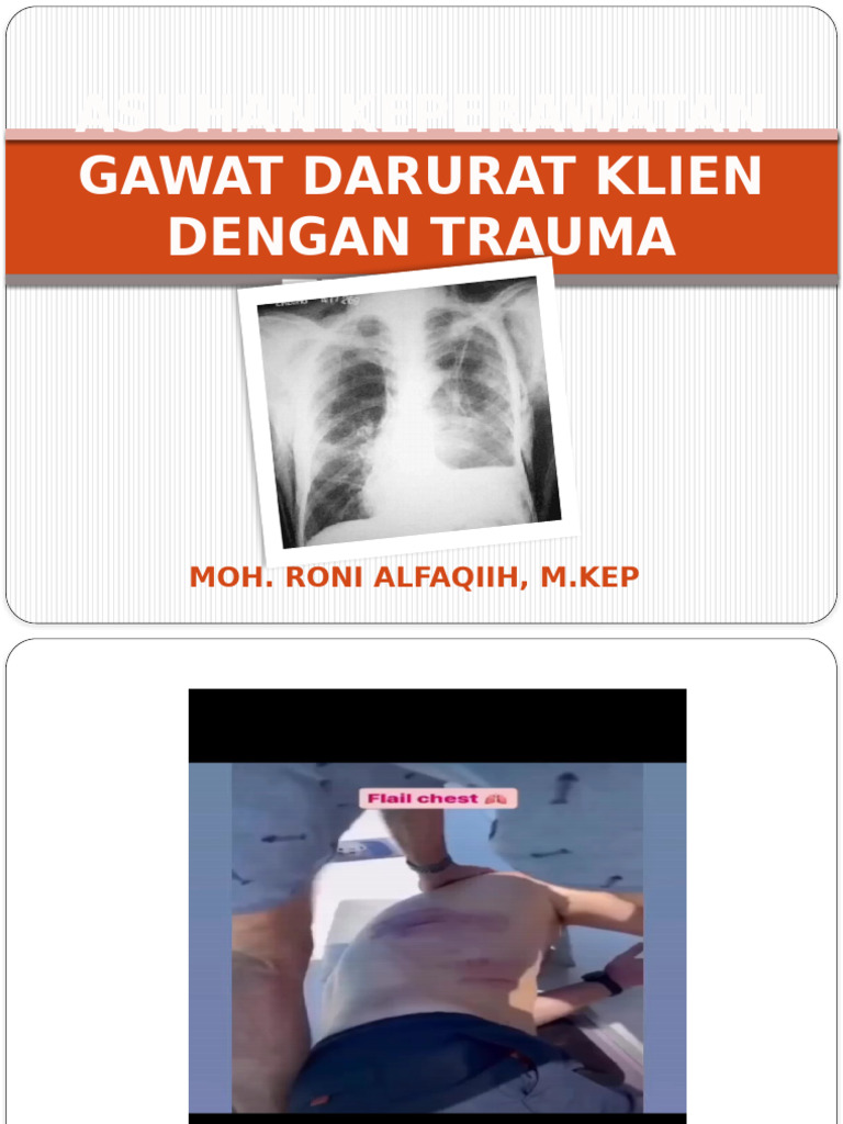 Tm 5 Askep Gadar Trauma Thoraks | PDF