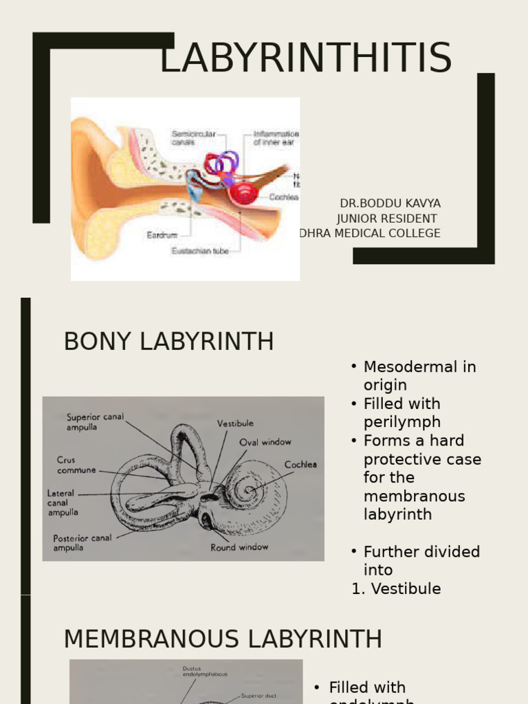 Labyrinthitis-1 | PDF | Vertigo | Ear